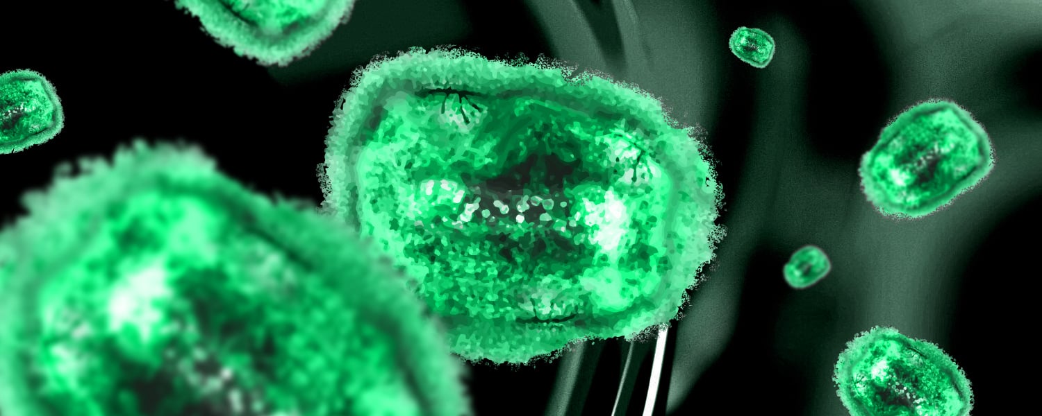 Common Gamma Chain Cytokines in Cancer Immunotherapy Common Gamma Chain Cytokines in Cancer Immunotherapy